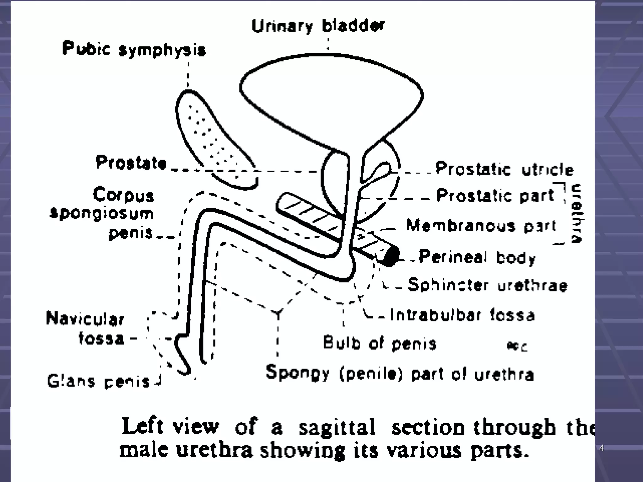 Uretheral stricture | PPT