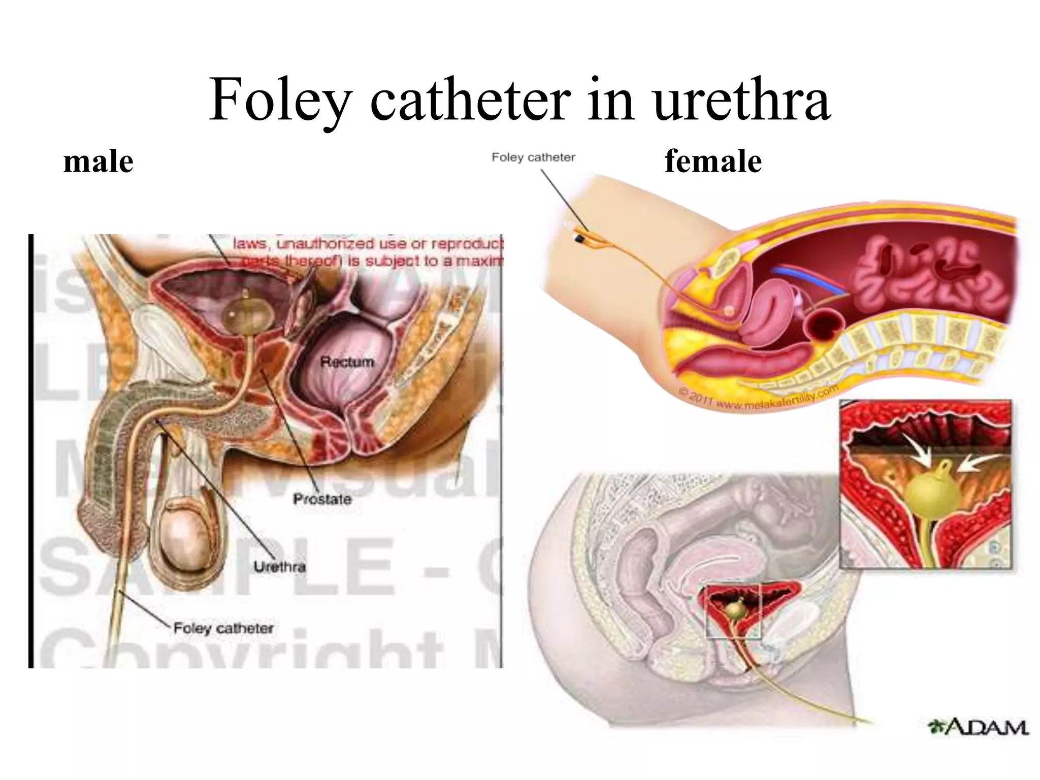 Urethra | PPTX