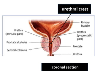 Urethral Crest