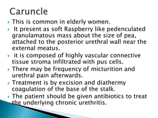 Urethra-WPS Office.pptx