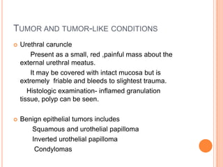 Urethra and male genital system | PPTX