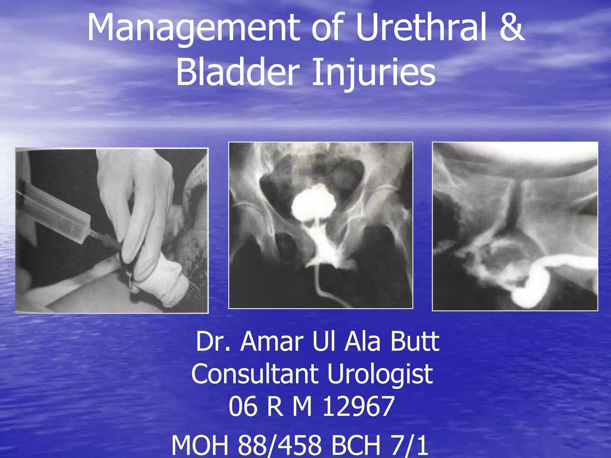 Urethral & bladder injury | PPT