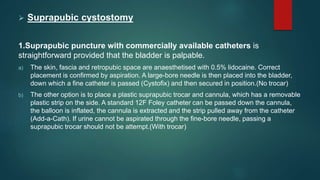 Urethral catheterisation | PPTX