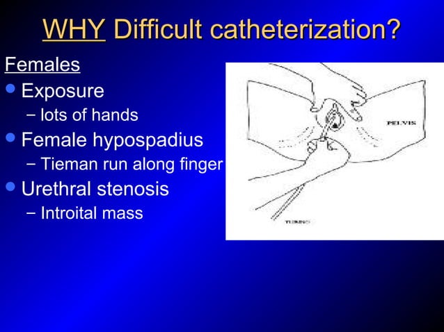 urethralcatheterization-160908091742 (1).pdf
