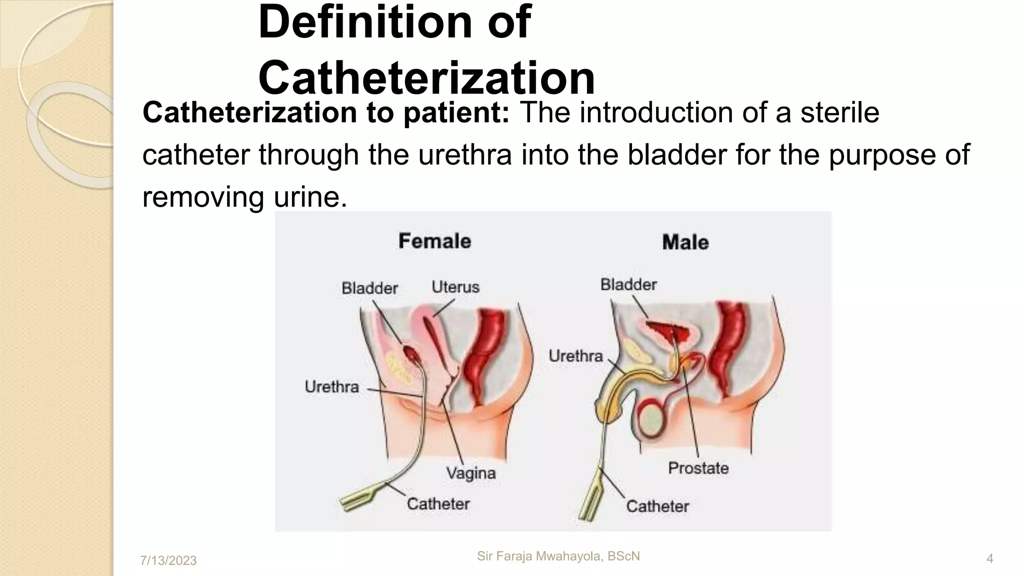 Guidelines For Difficult Urethral Catheterization In Males – AWBR