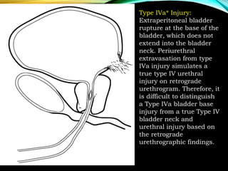 IMAGING OF URETHRAL INJURY | PPTX