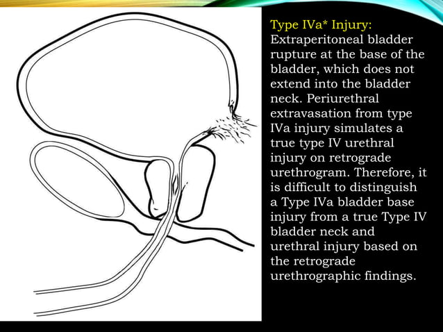 IMAGING OF URETHRAL INJURY | PPTX | Sexual Conditions | Sexual Health