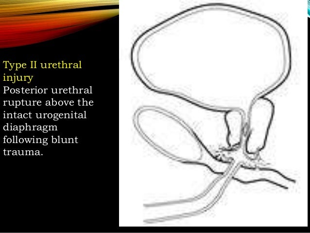IMAGING OF URETHRAL INJURY