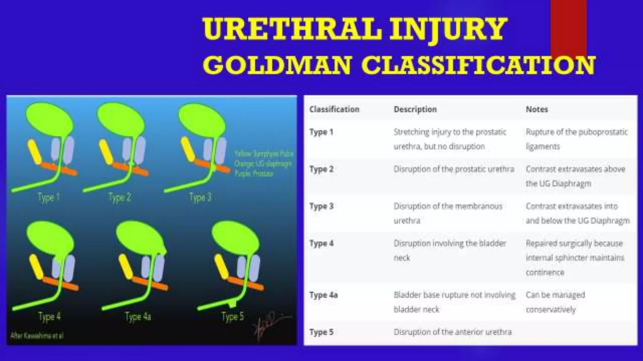 URETHRAL INJURY- Trauma Surgery | PPTX