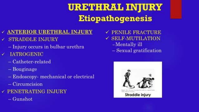 URETHRAL INJURY- Trauma Surgery | PPTX