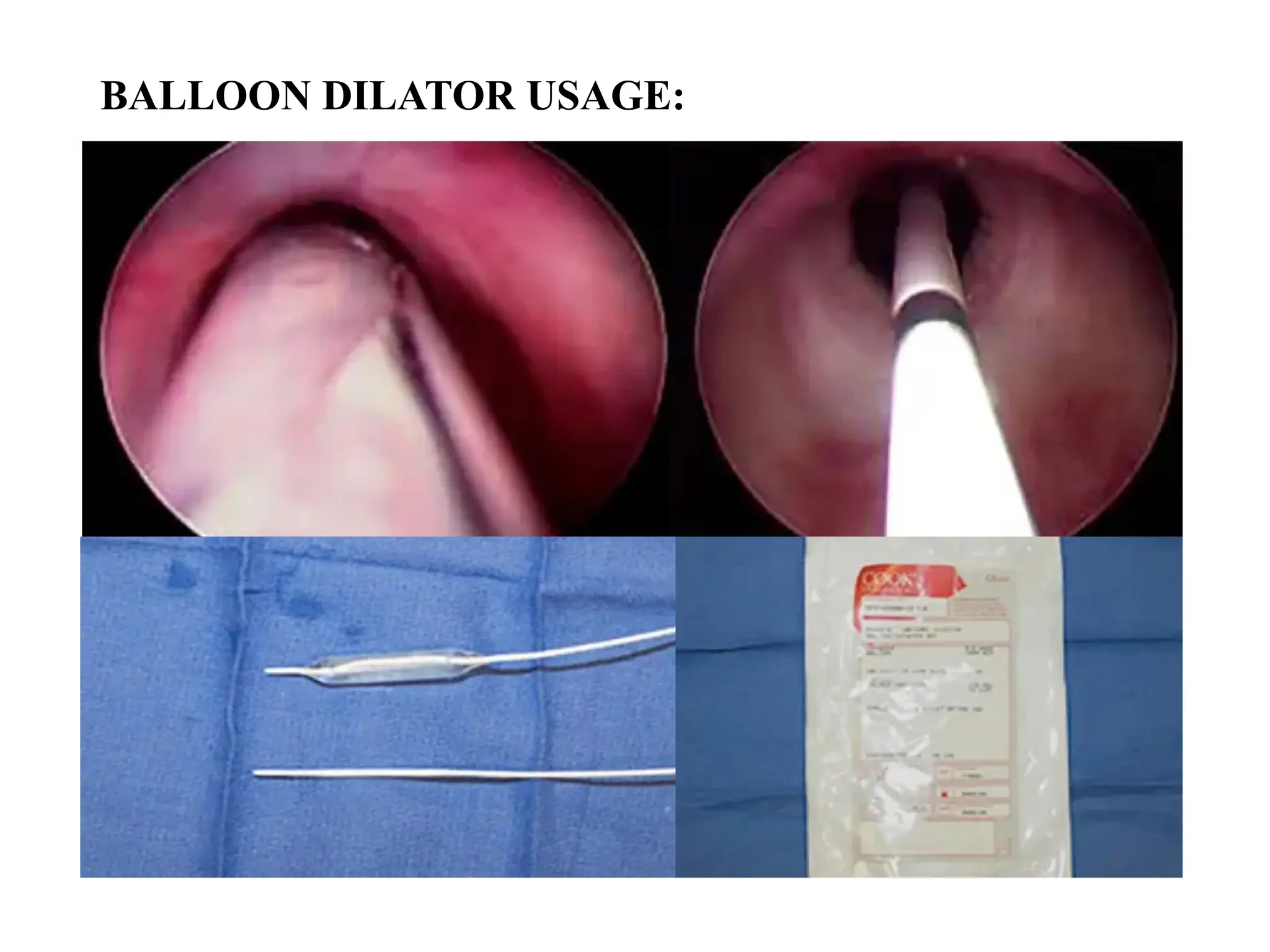 URETHRAL INJURY: BRIEF SURGICAL MANAGEMENT | PPT