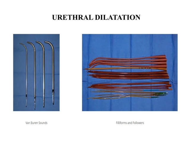 URETHRAL INJURY: BRIEF SURGICAL MANAGEMENT | PPT