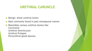 URETHRAL INJURY AND URETHRAL CARUNCLE.pptx