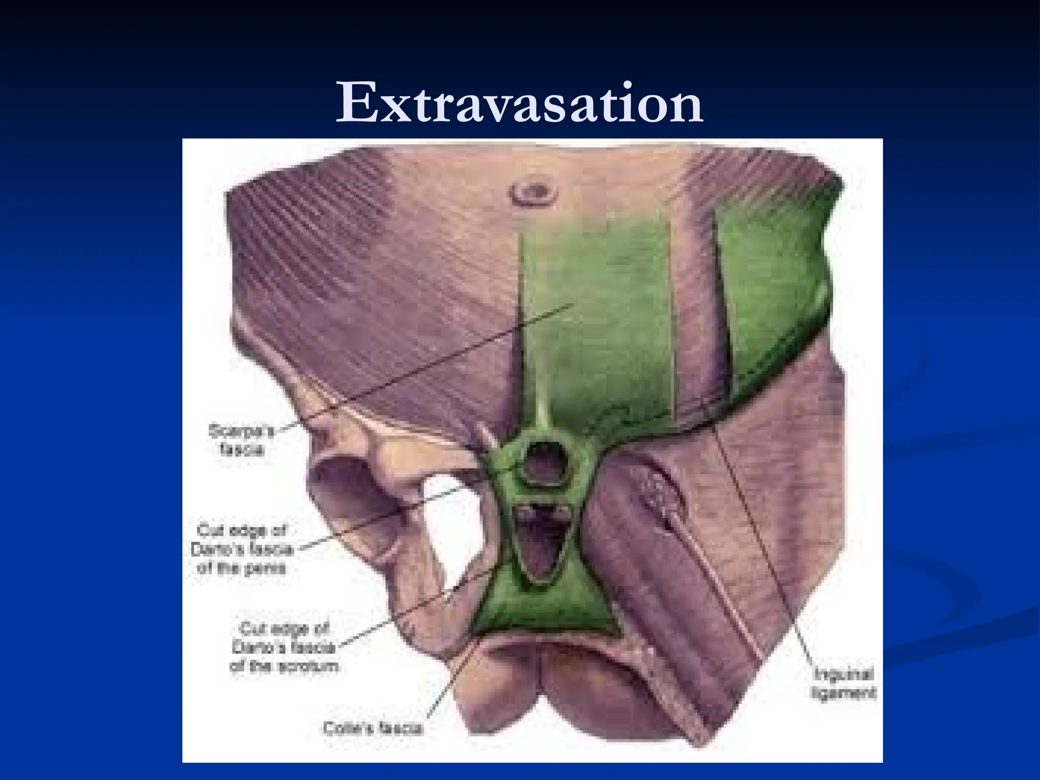 Urethral injuries: anatomical consideration and initial management by Prof Dr Samir Orabi MD | PPTX