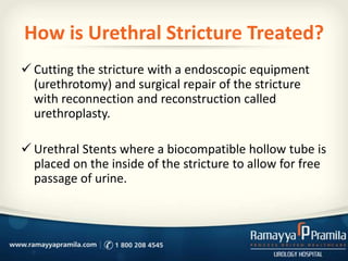 Urethral stricture | PPTX