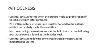 Urethral stricture | PPT