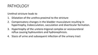 Urethral stricture | PPT