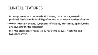 Urethral stricture | PPT