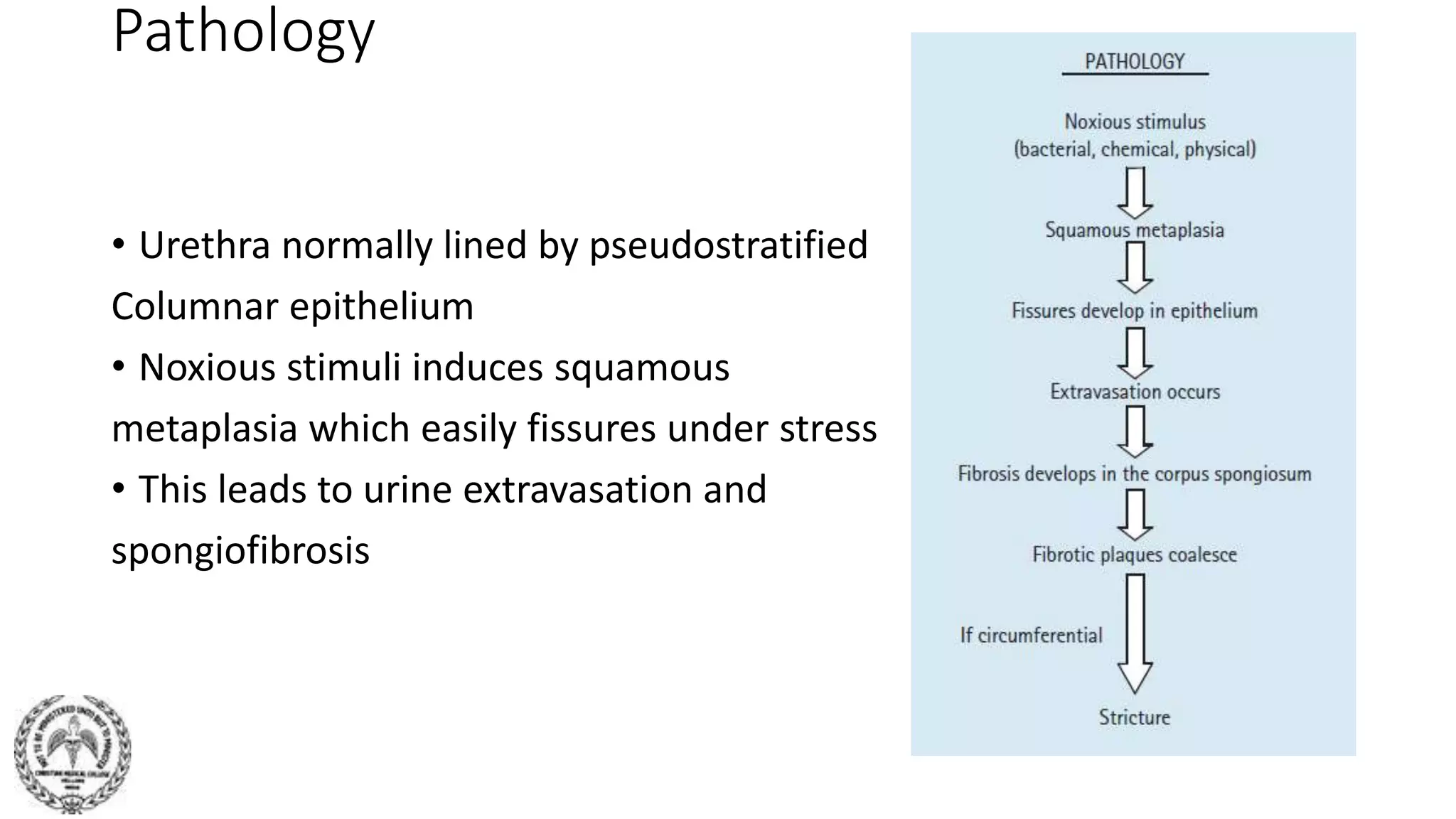 Urethral stricture.pptx