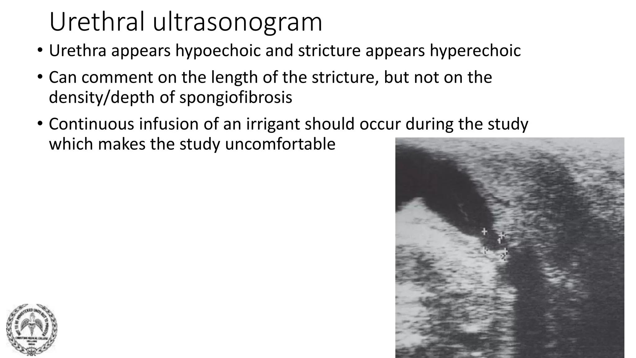 Urethral stricture.pptx