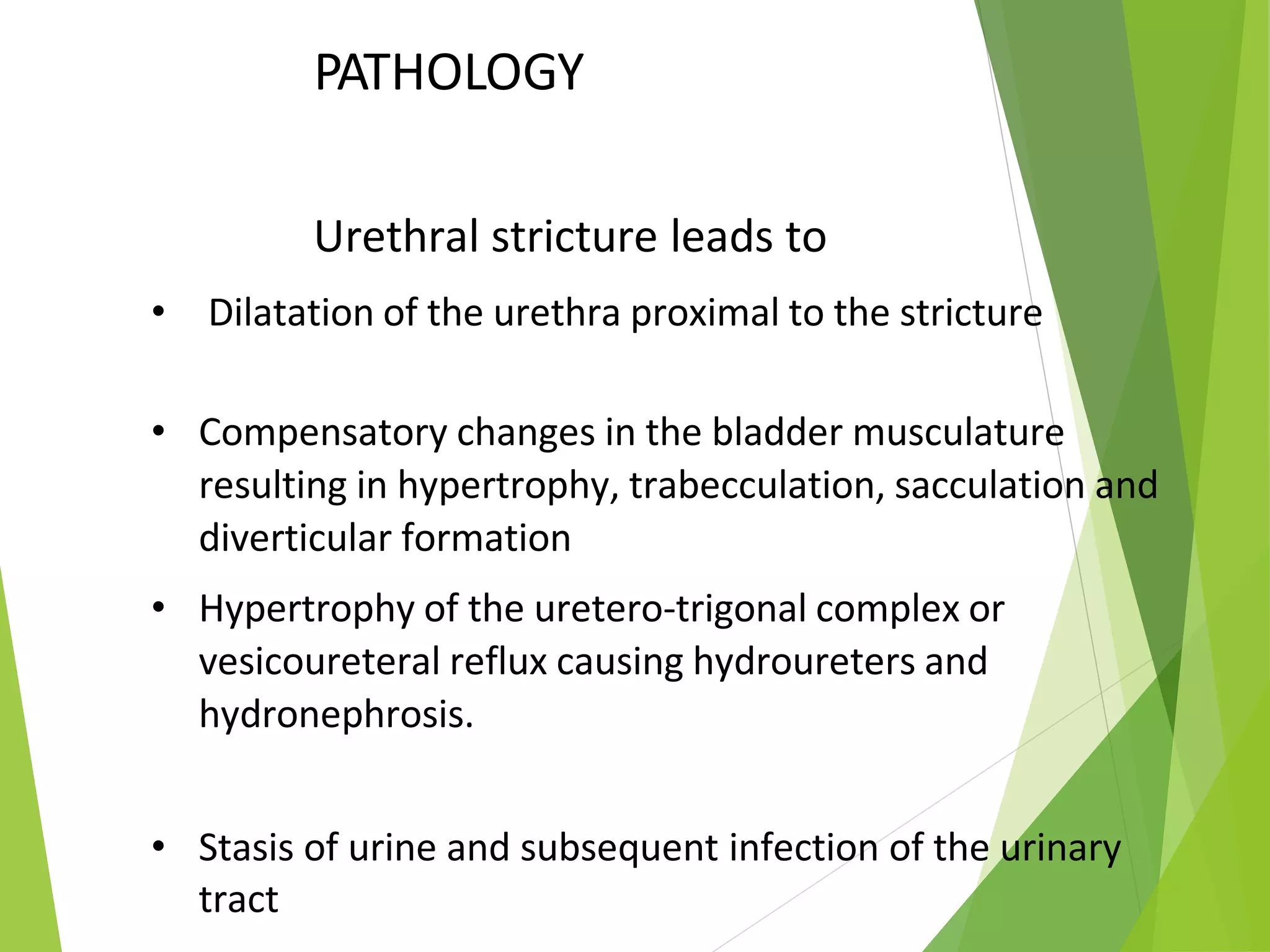 Urethral stricture.pptx