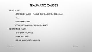 URETHRAL STRICTURE AND ITS MANAGEMENT.pptx