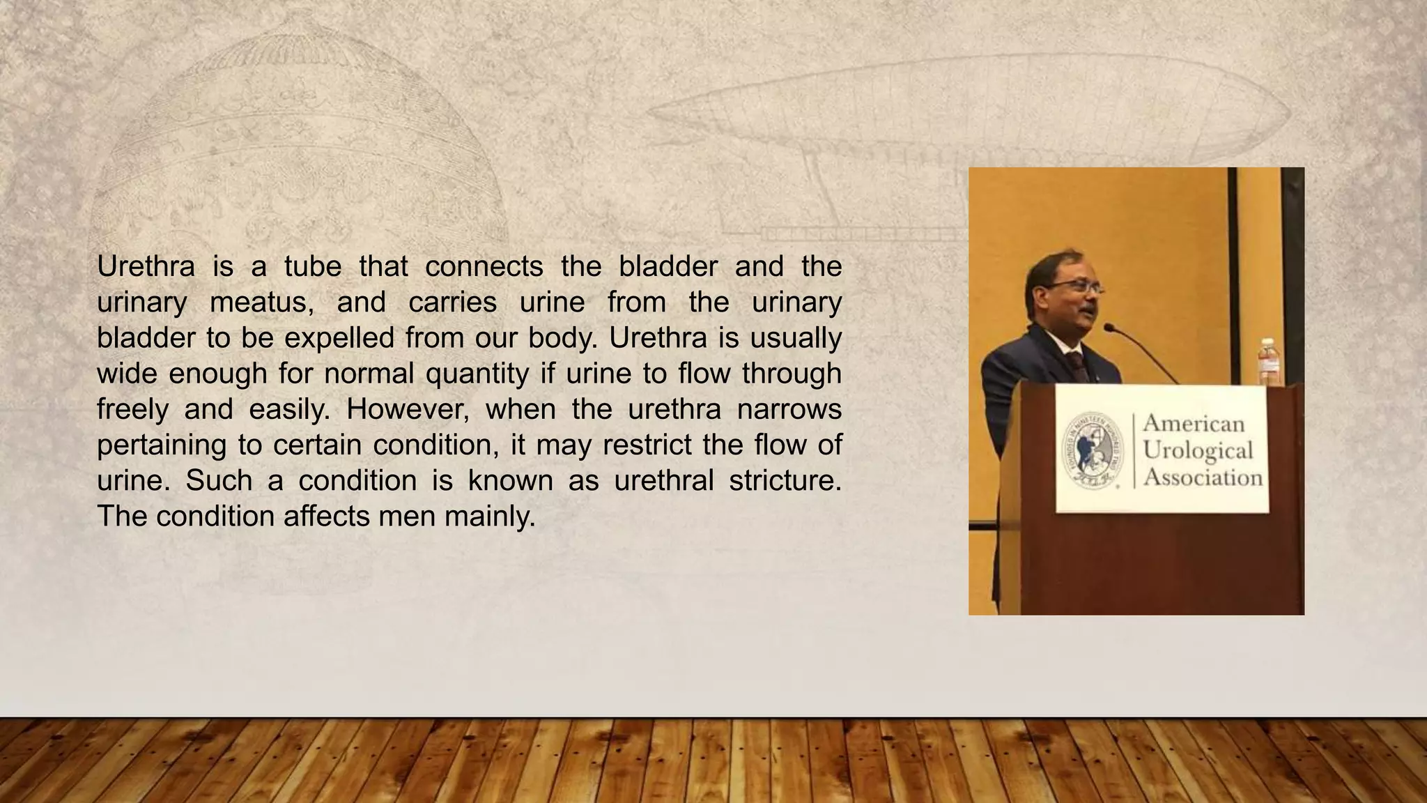 Urethral Stricture Causes, Risk Factors, And Diagnosis | PPTX