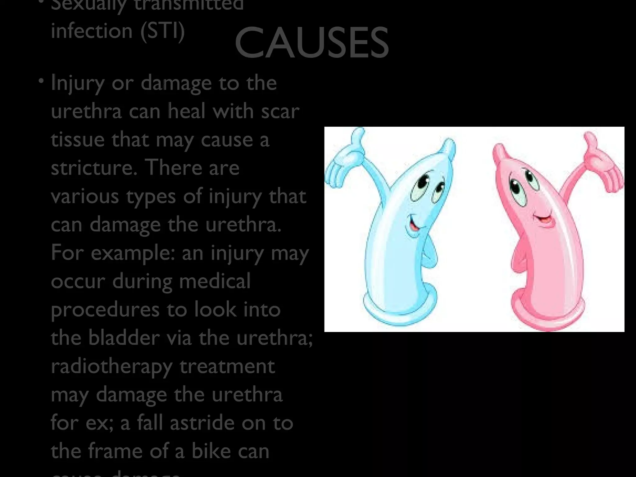 Urethral stricture period 1 | PPT