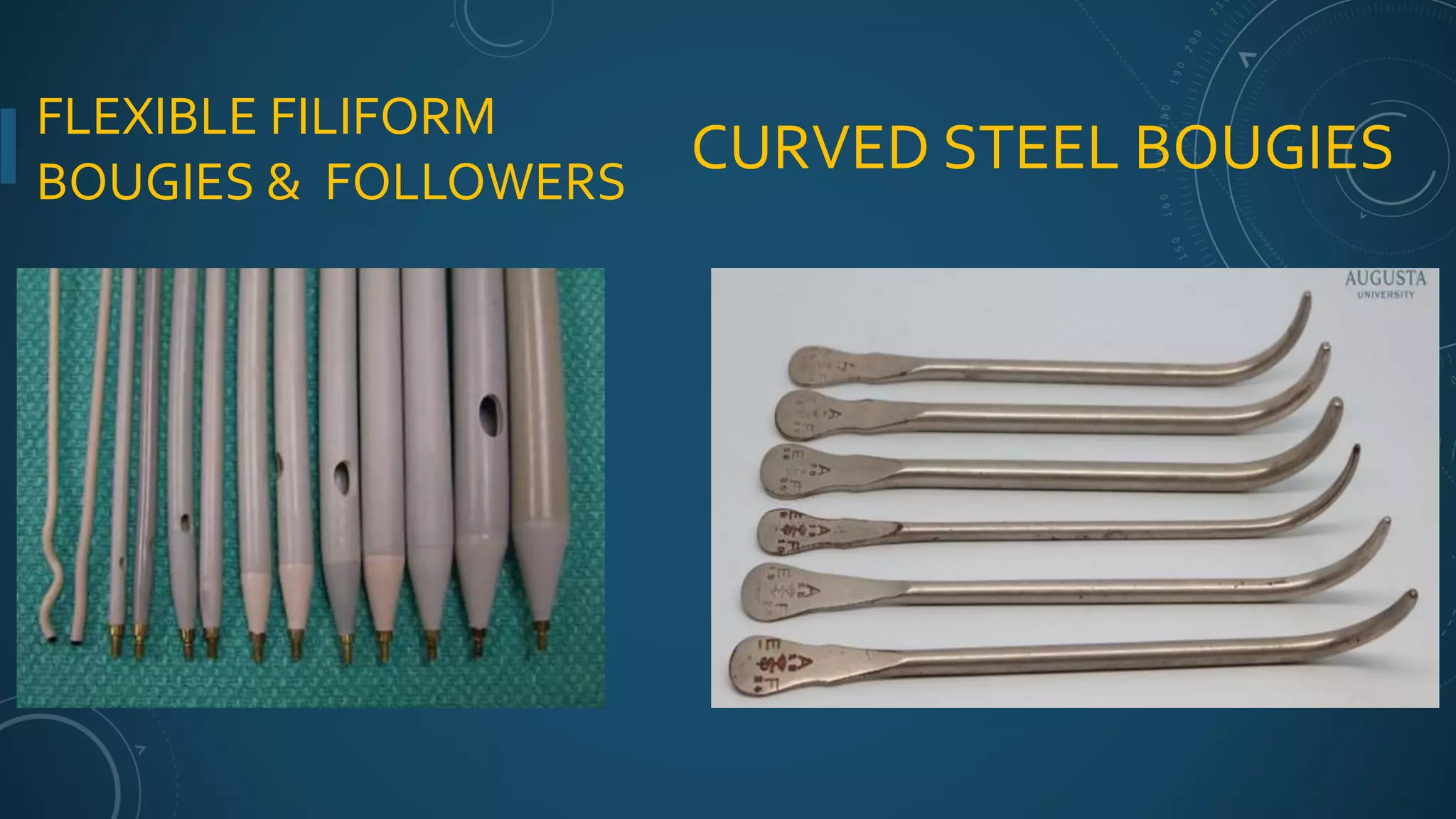 Urethral strictures | PPTX