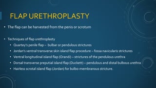 Urethral strictures | PPTX