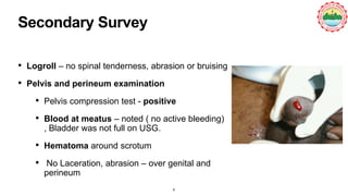 Approach to the patient with Urethral Trauma | PPTX