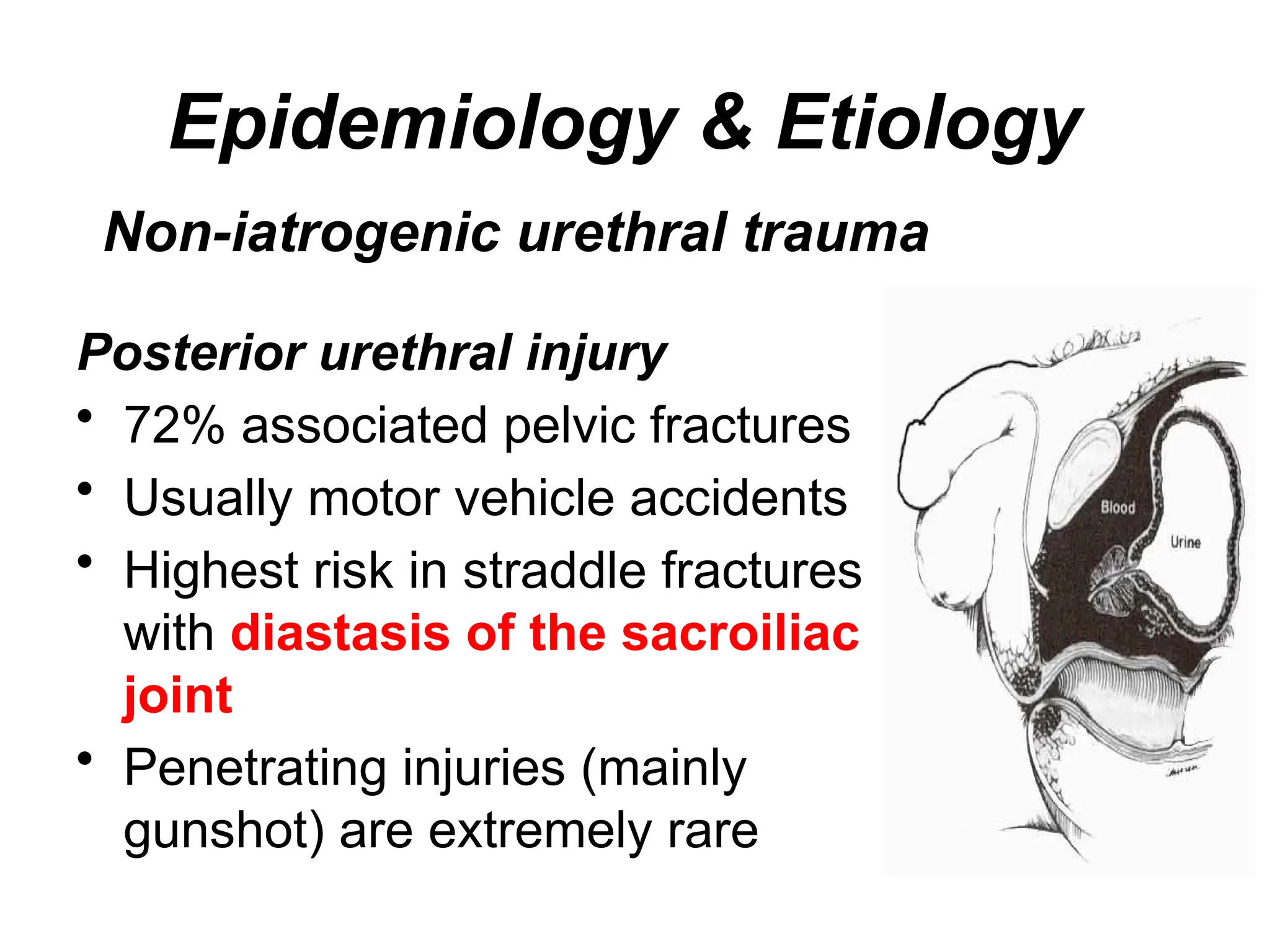 Urethral Trauma for postgraduate by Professor Dr. Mohamed Hindawy ...