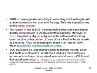 Urethra stricture etiopathogenesis & evaluation | PDF