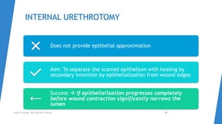 Urethra stricture management- minimally invasive | PDF
