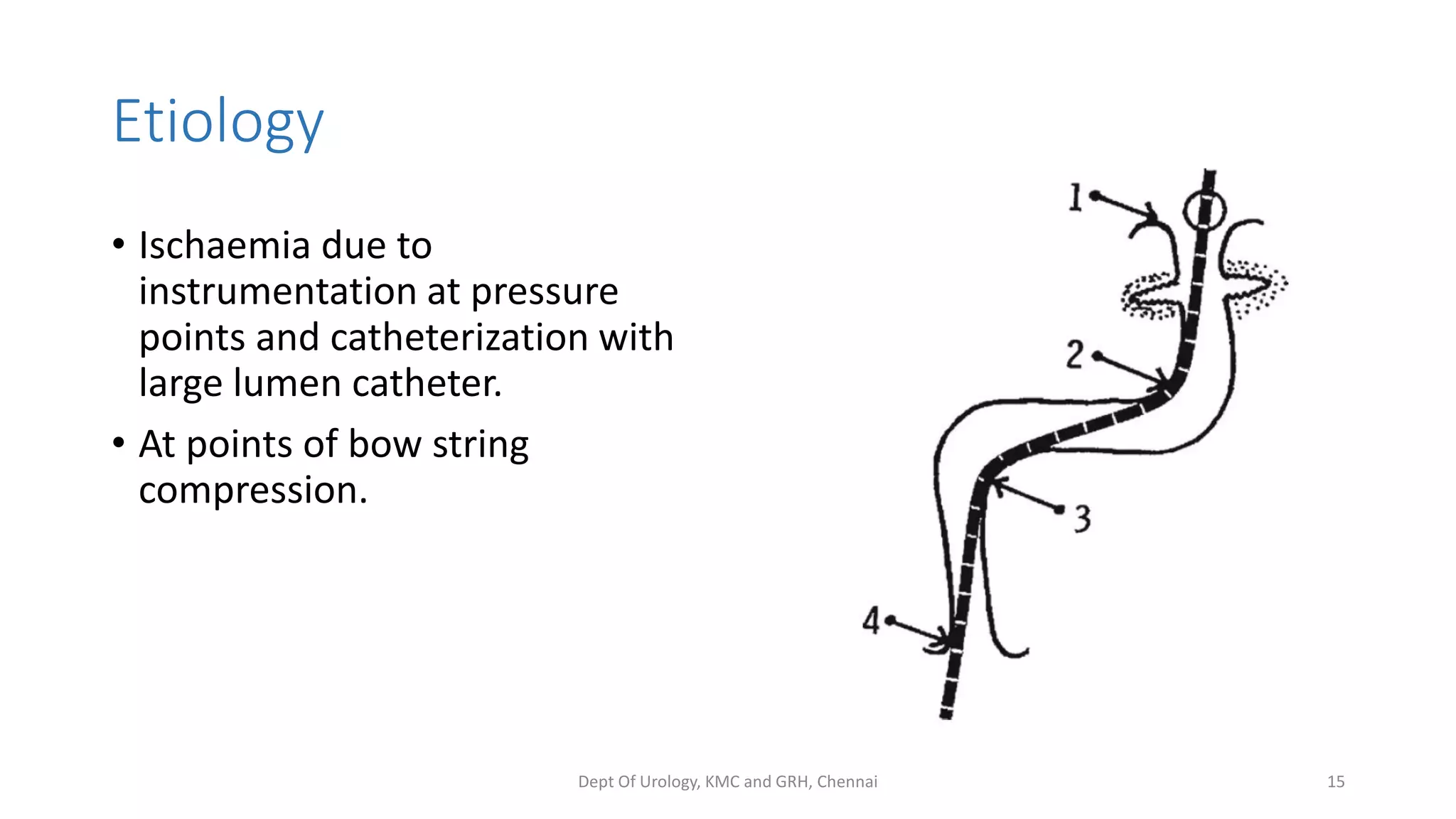 Urethra stricture overview | PDF