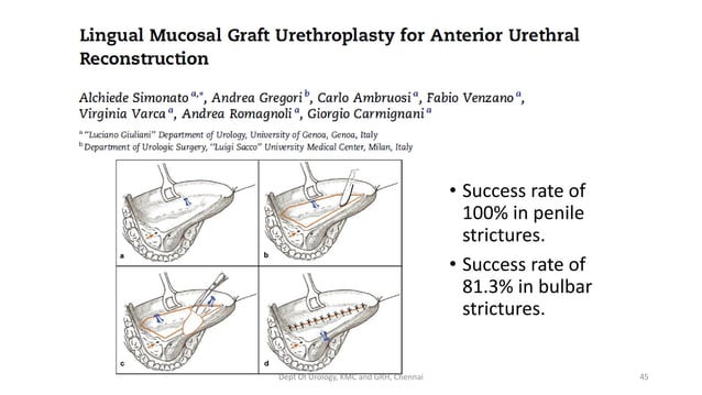 Urethra stricture overview | PDF | Sexual Conditions | Sexual Health