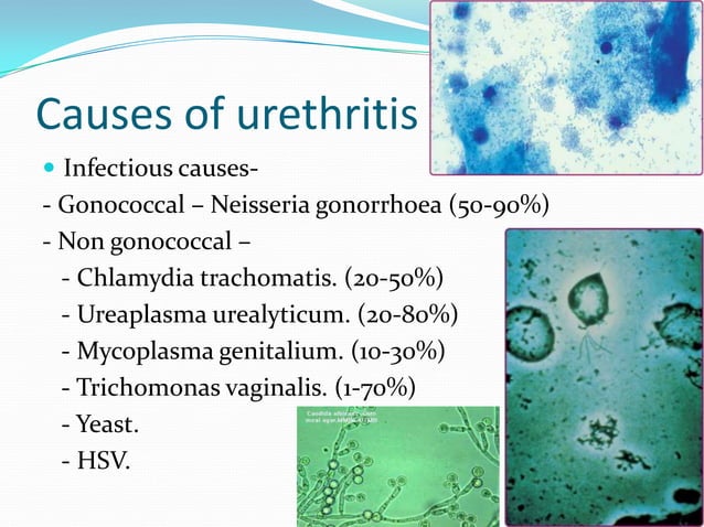 Urethritis