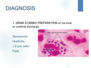 Urethritis | PPTX