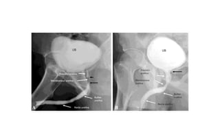 urethrogram.pptx