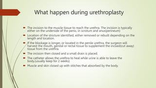 URETHROPLASTY.pptx