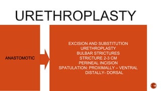 Urethroplasty history and advancements.pptx | Shaving | Personal Care