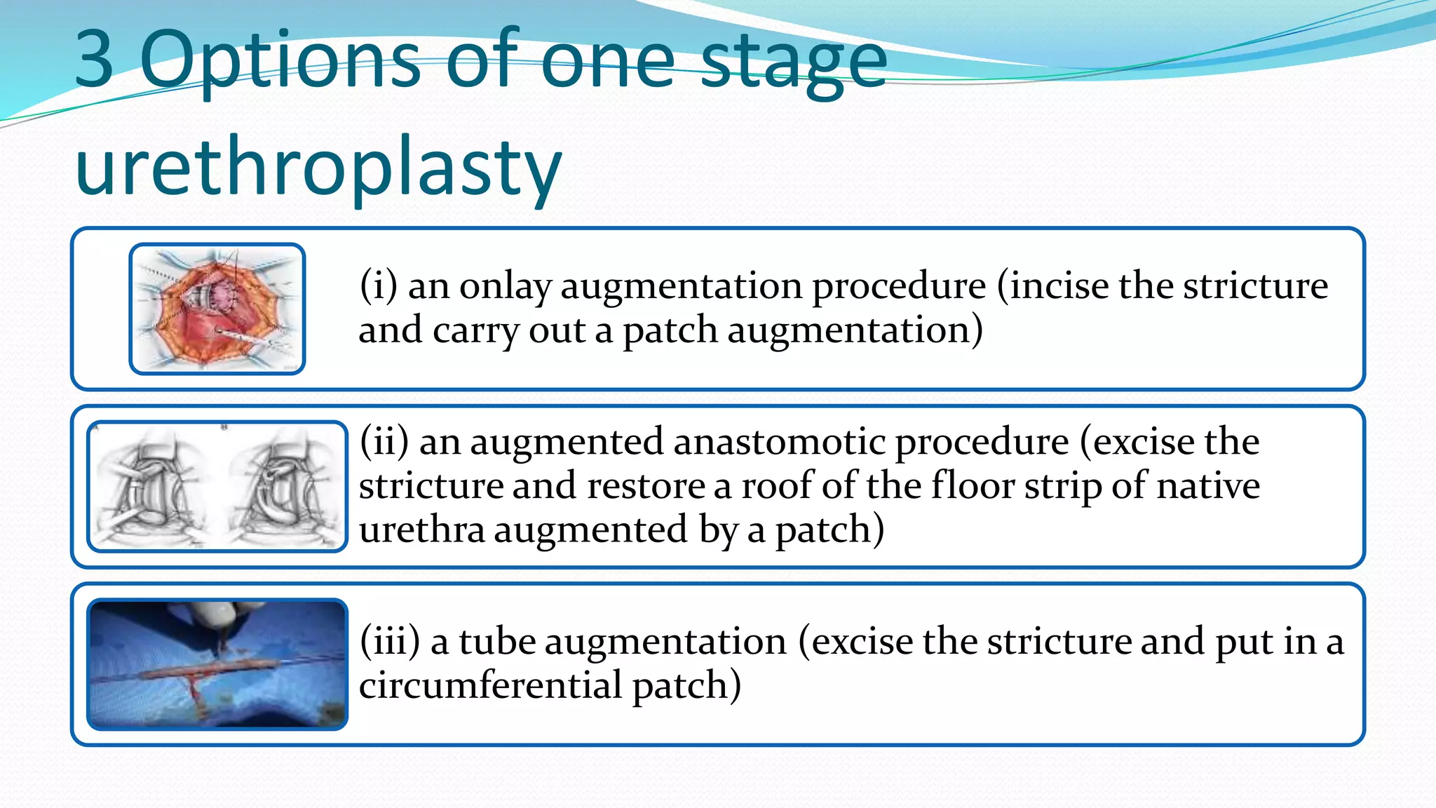 Urethroplasty principles and practicess.pptx