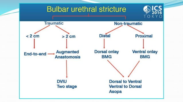 Urethroplasty principles and practicess.pptx | Surgery | Medical Health