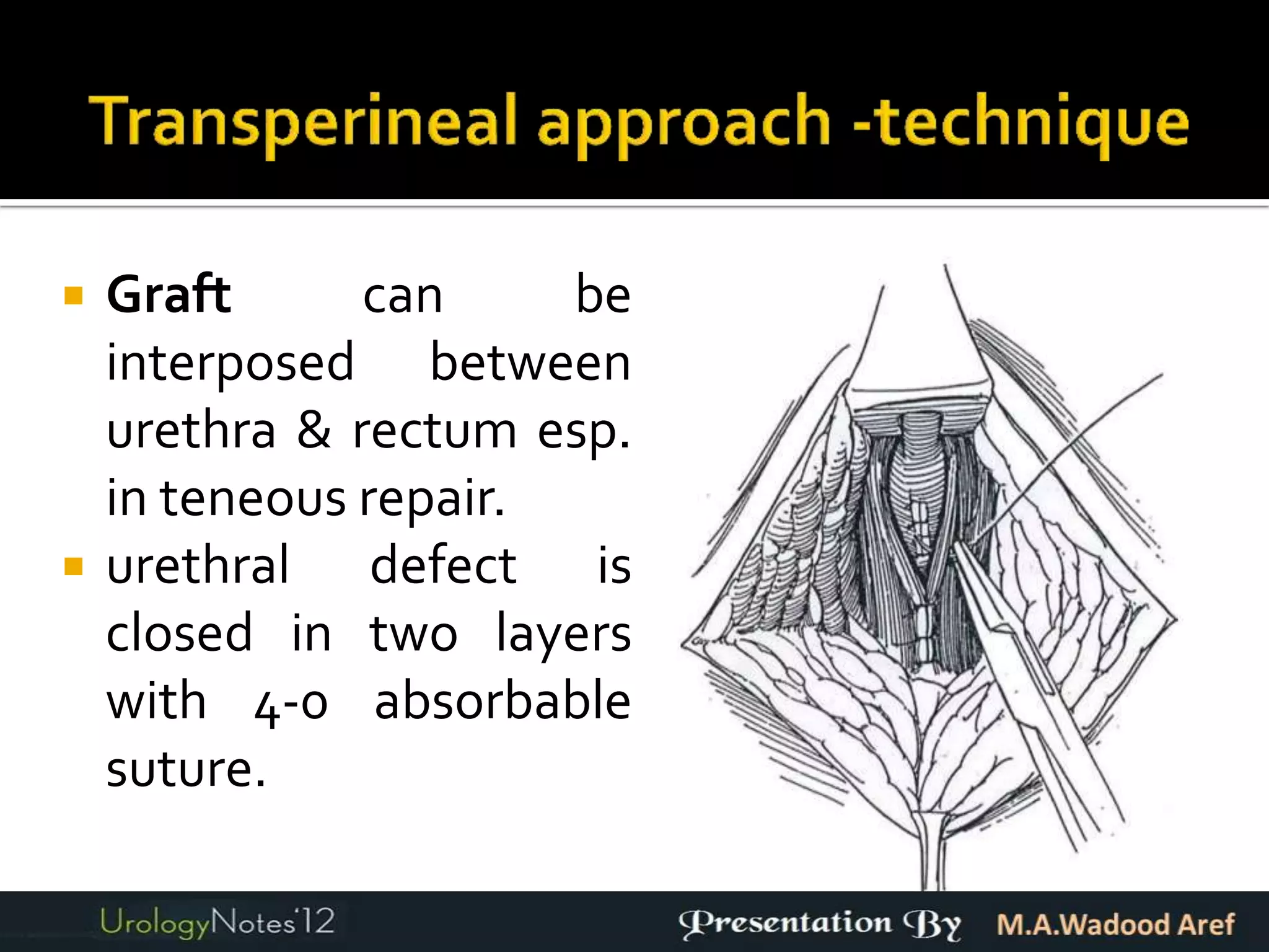 Urethrorectal fistula | PDF