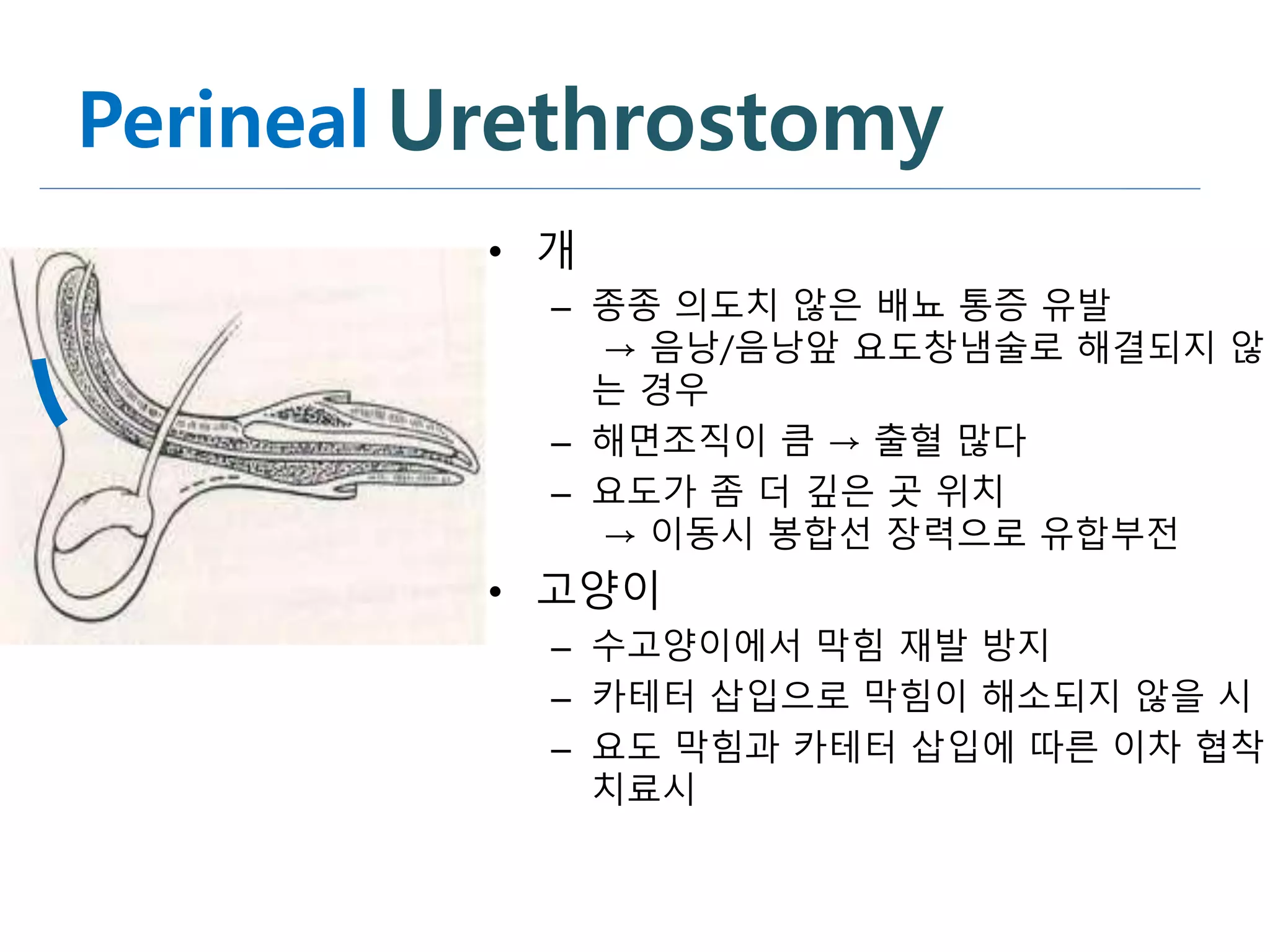 Urethrostomy 요도창냄술 | PPTX