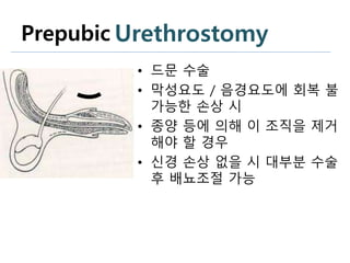 Urethrostomy 요도창냄술 | PPTX