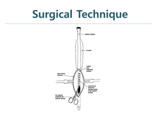 Urethrostomy 요도창냄술 | PPTX