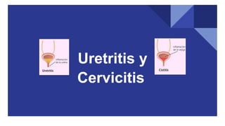 uretritis y cervicitis enfermedad fanny.pptx