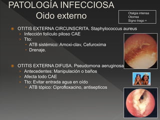 Urgencias en orl | PPTX
