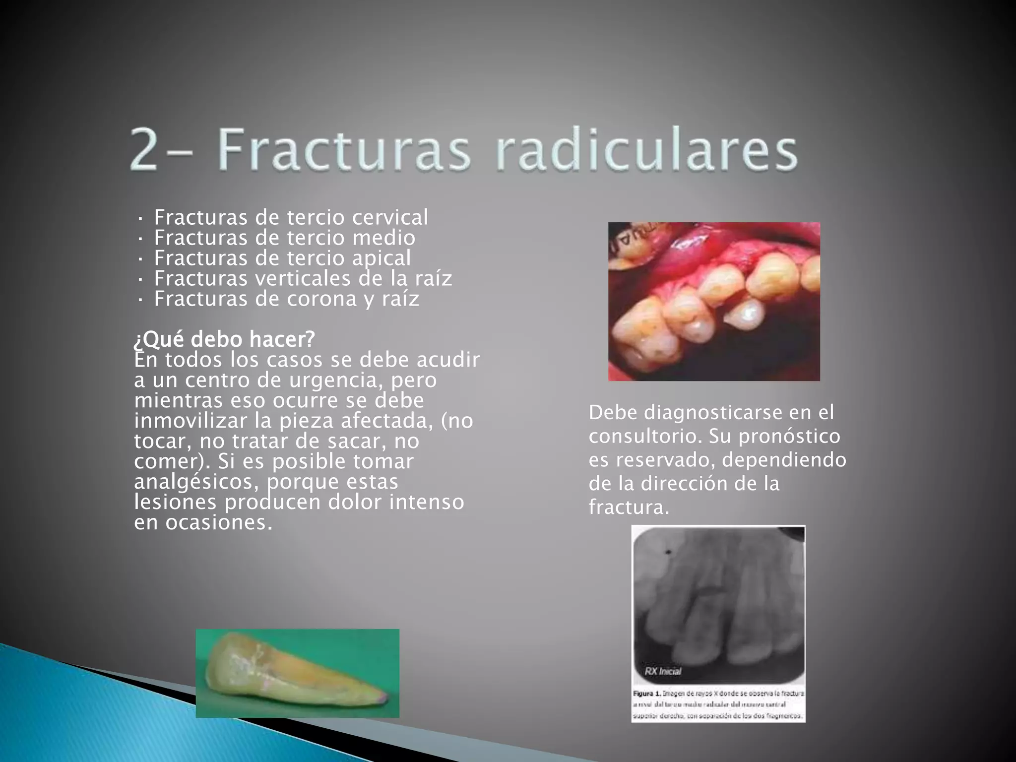 Urgencias mas frecuentes en odontologia | PPTX